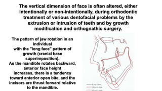 Orthodontic vertical discrepancies 1- LONG FACE | PPTX
