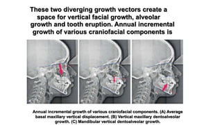 Orthodontic vertical discrepancies 1- LONG FACE | PPTX