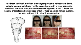 Orthodontic vertical discrepancies 1- LONG FACE | PPTX