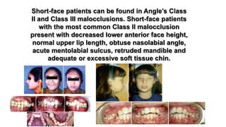 Orthodontic vertical discrepancies 1- LONG FACE | PPTX