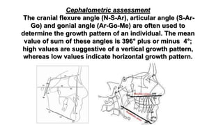 Orthodontic vertical discrepancies 1- LONG FACE | PPTX