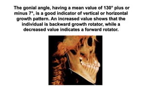 Orthodontic vertical discrepancies 1- LONG FACE | PPTX