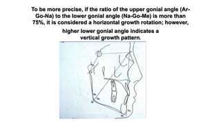 Orthodontic vertical discrepancies 1- LONG FACE | PPTX