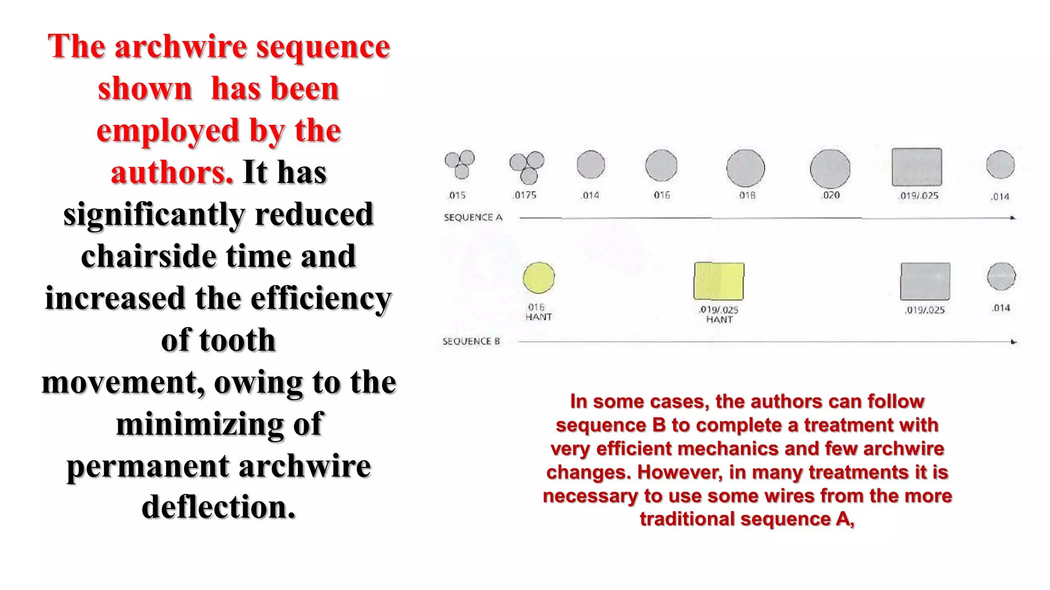MBT wire sequence during orthodontic alignment and leveling | PPTX