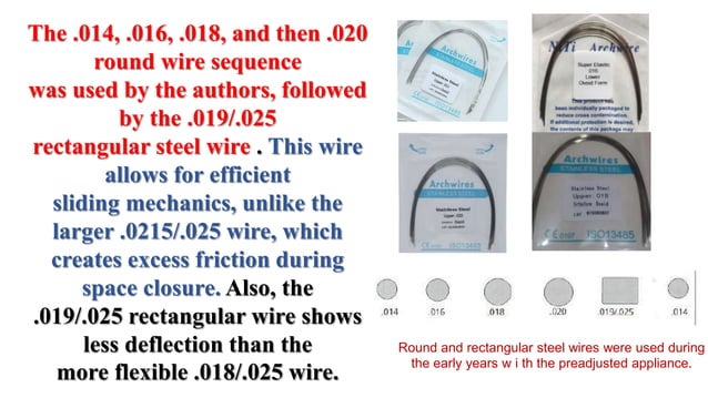 MBT wire sequence during orthodontic alignment and leveling | PPTX ...