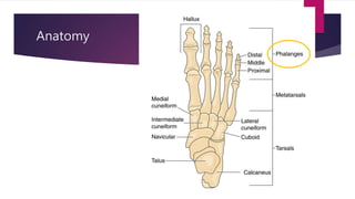 Toe fracture | PPTX