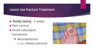 Toe fracture | PPTX
