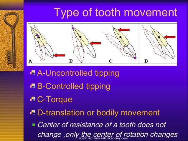 Ortho force systems /certified fixed orthodontic courses by Indian de…