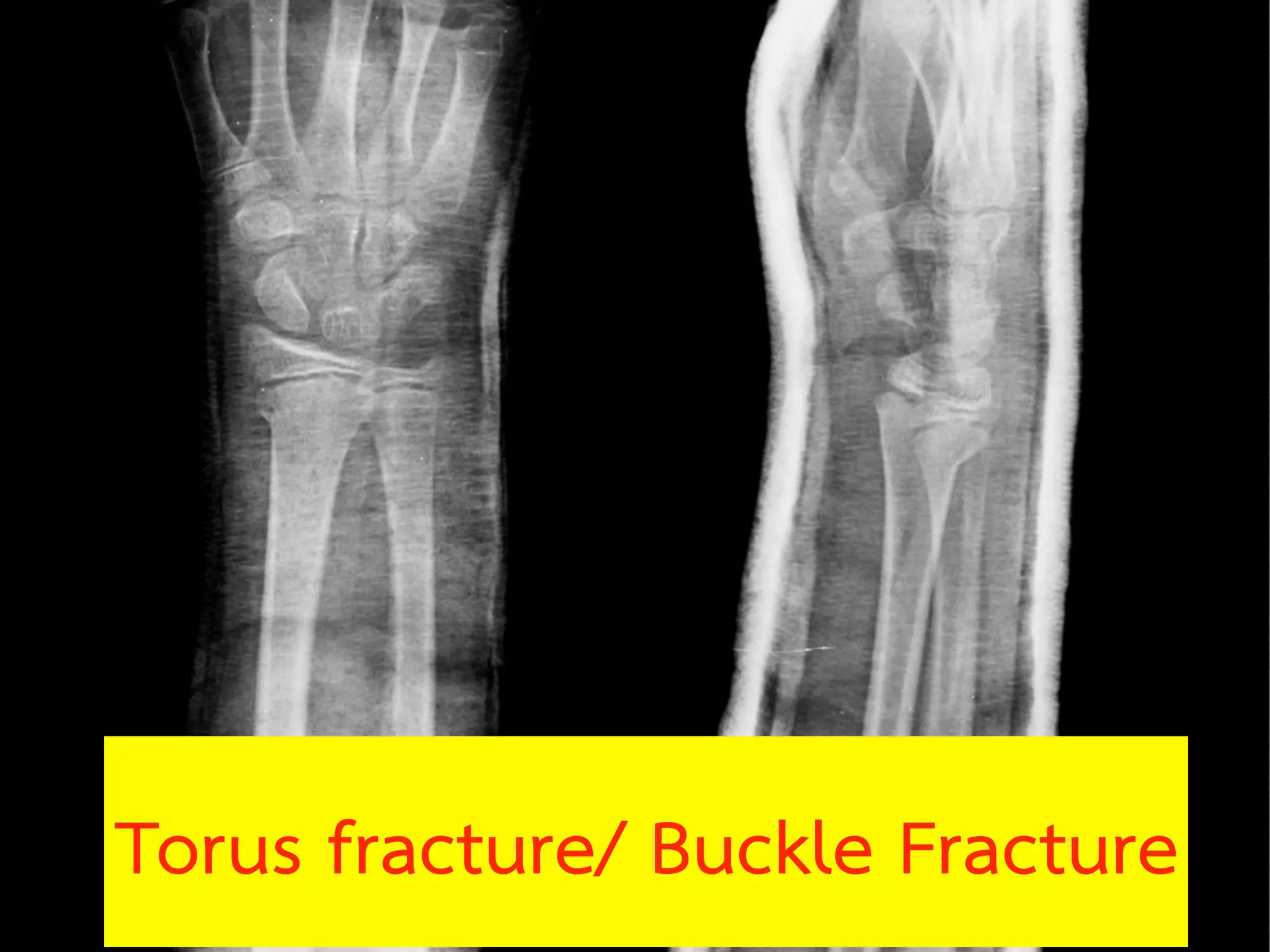 Common Hand Injury | PPT