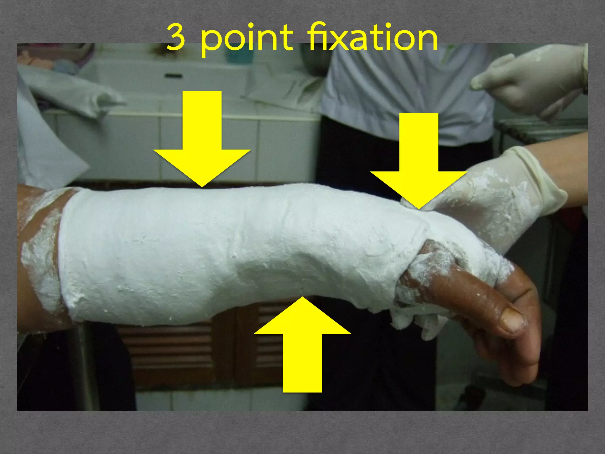 Common Hand Injury | PPT