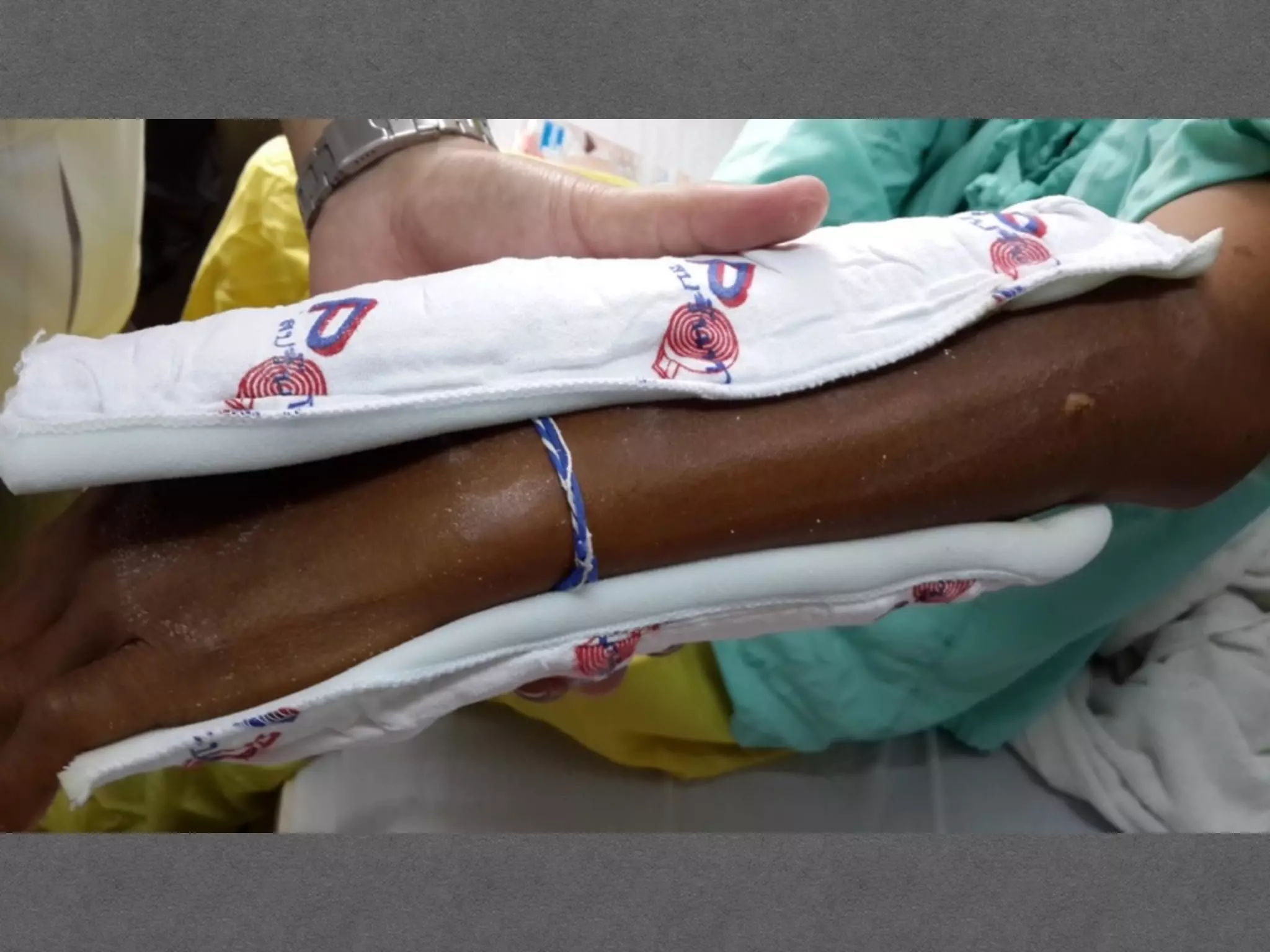 Common Hand Injury | PPT