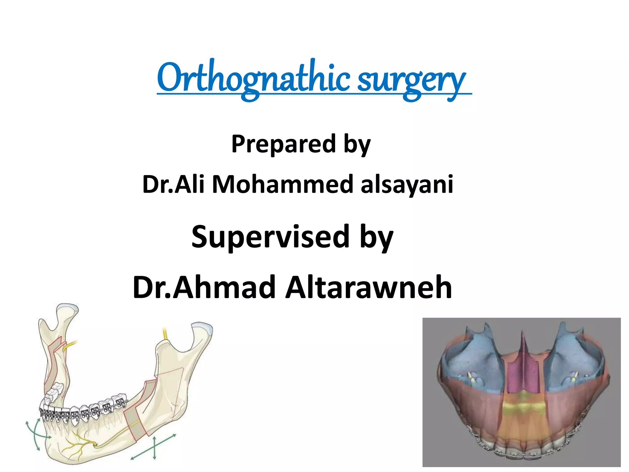 Orthognathic surgery | PPTX