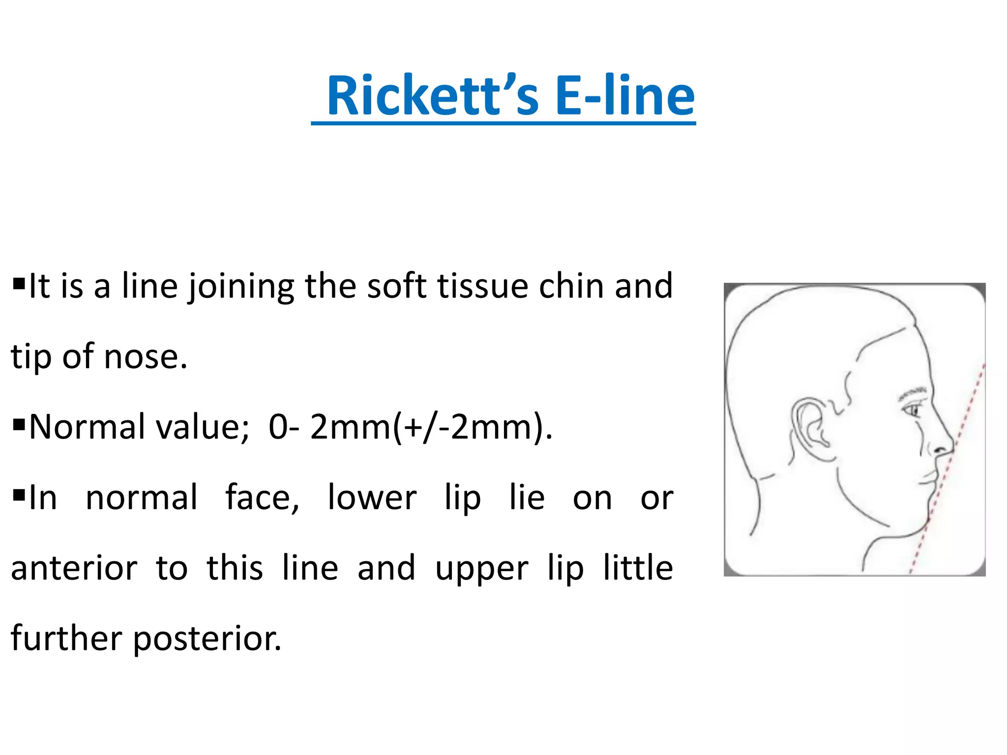 Orthognathic surgery | PPTX