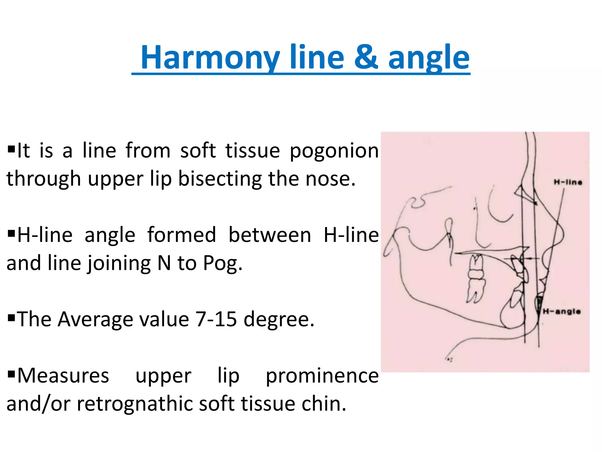 Orthognathic surgery | PPTX