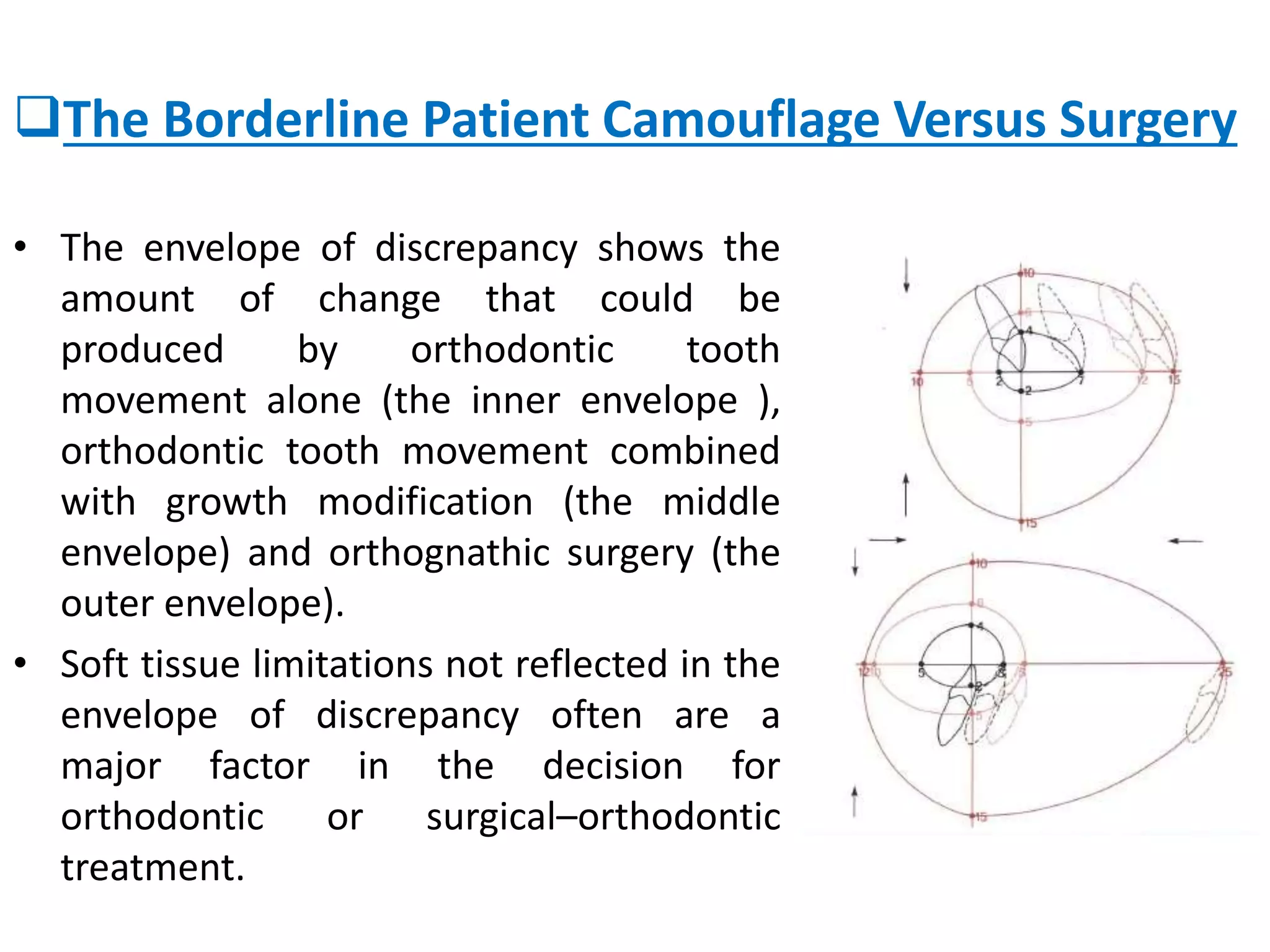 Orthognathic surgery | PPTX