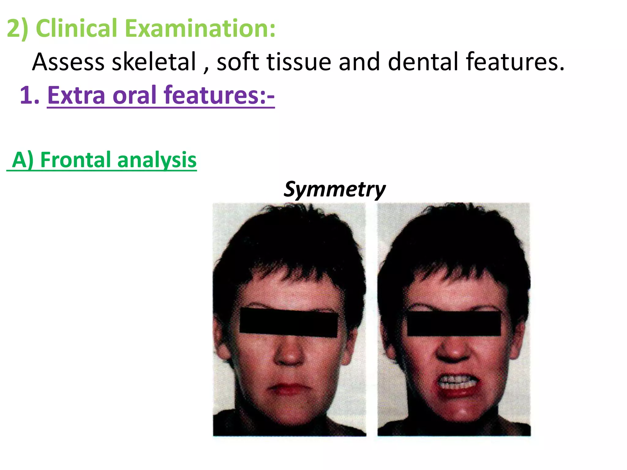 Orthognathic surgery | PPTX
