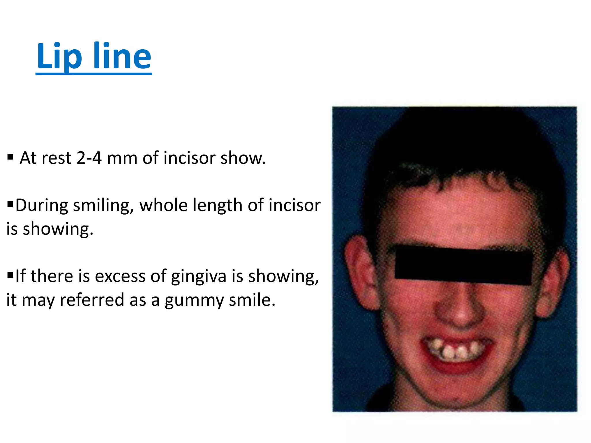 Orthognathic surgery | PPTX