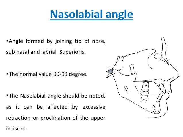 Orthognathic surgery