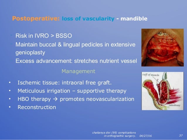 complications in orthognathic surgey