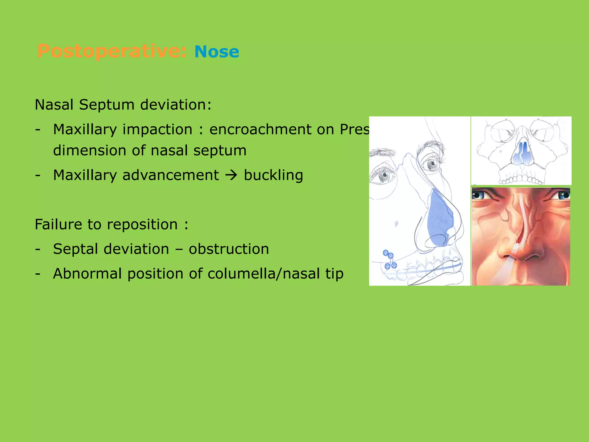 Orthognathic complications | PPT