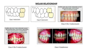 Orthognathic Surgery: diagnosis | PPTX