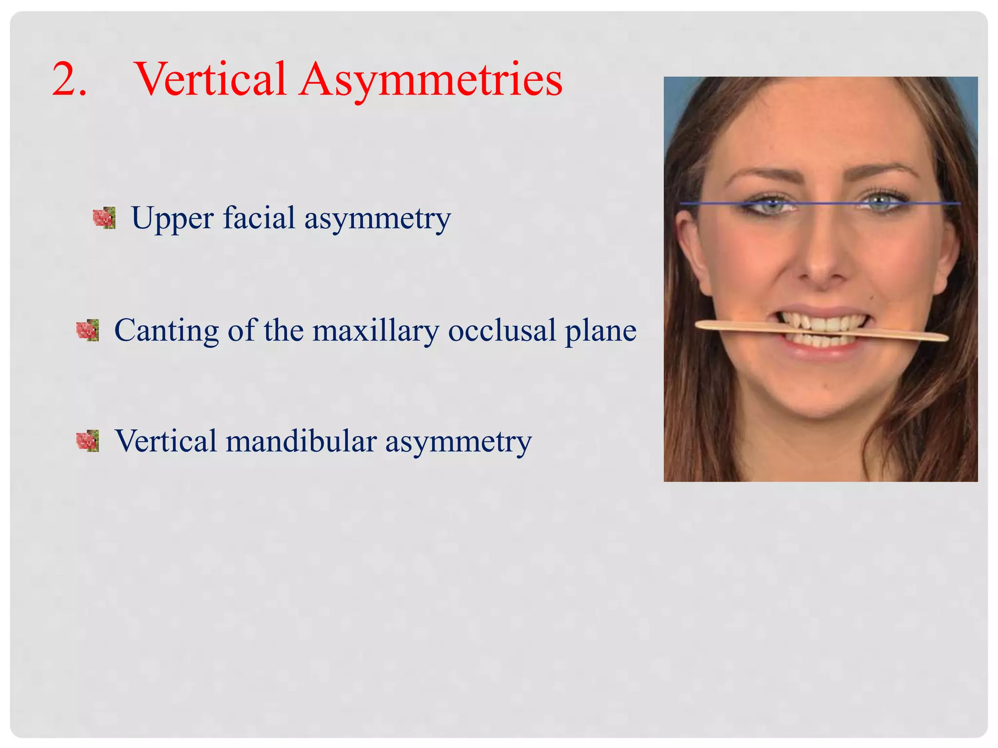 dentofacial assessment for orthognathic surgery by ALAA EL KASABY | PPTX