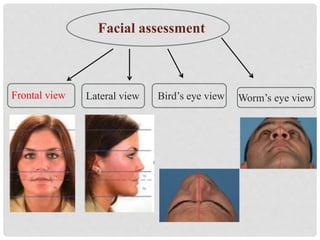 dentofacial assessment for orthognathic surgery by ALAA EL KASABY | PPTX