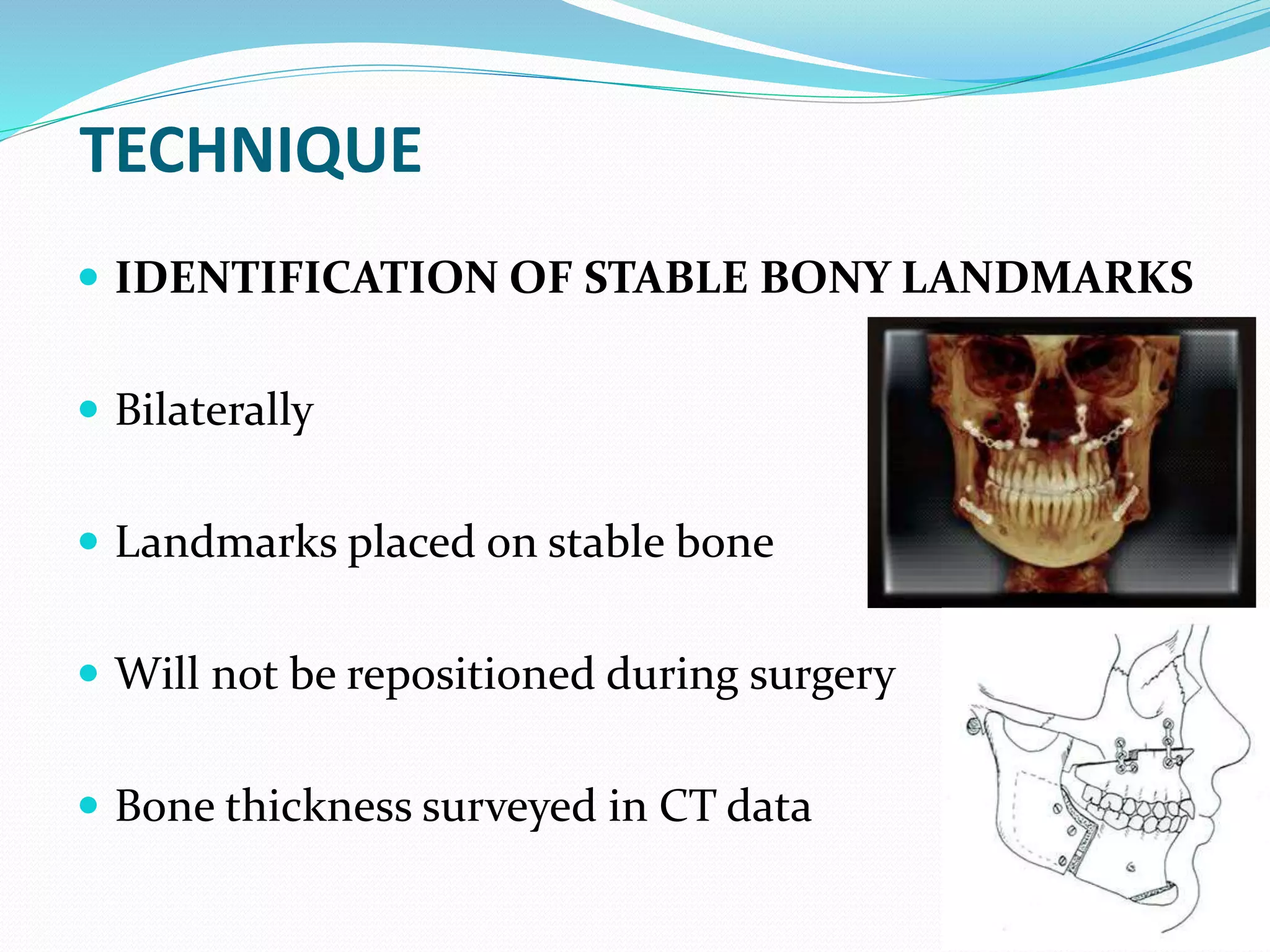 Orthognathic Positioning System | PPTX