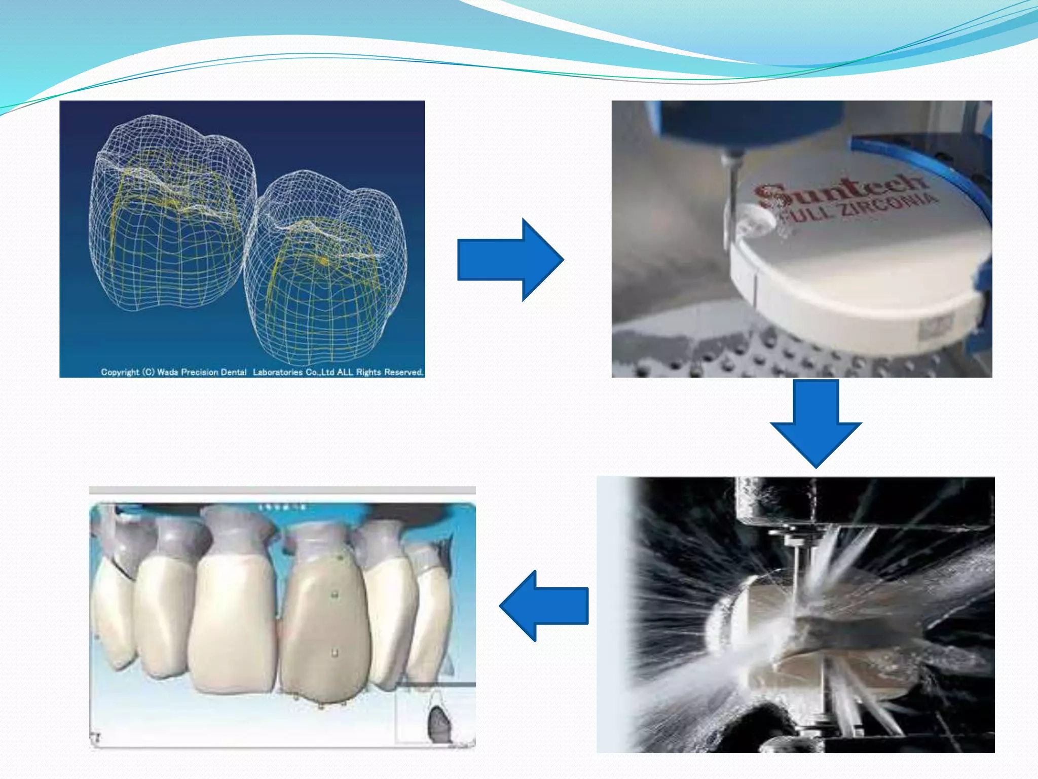 Orthognathic Positioning System | PPTX