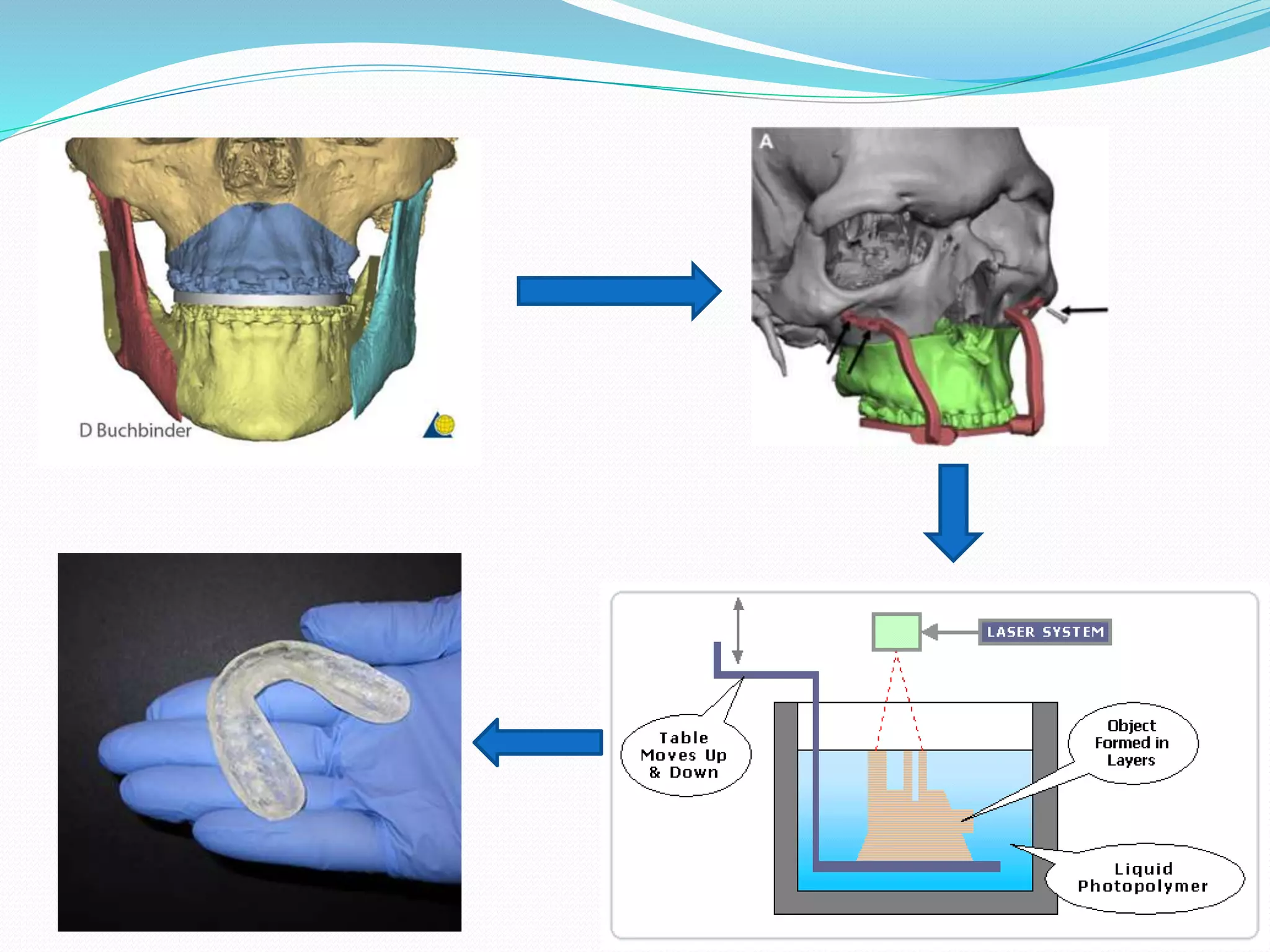 Orthognathic Positioning System | PPTX