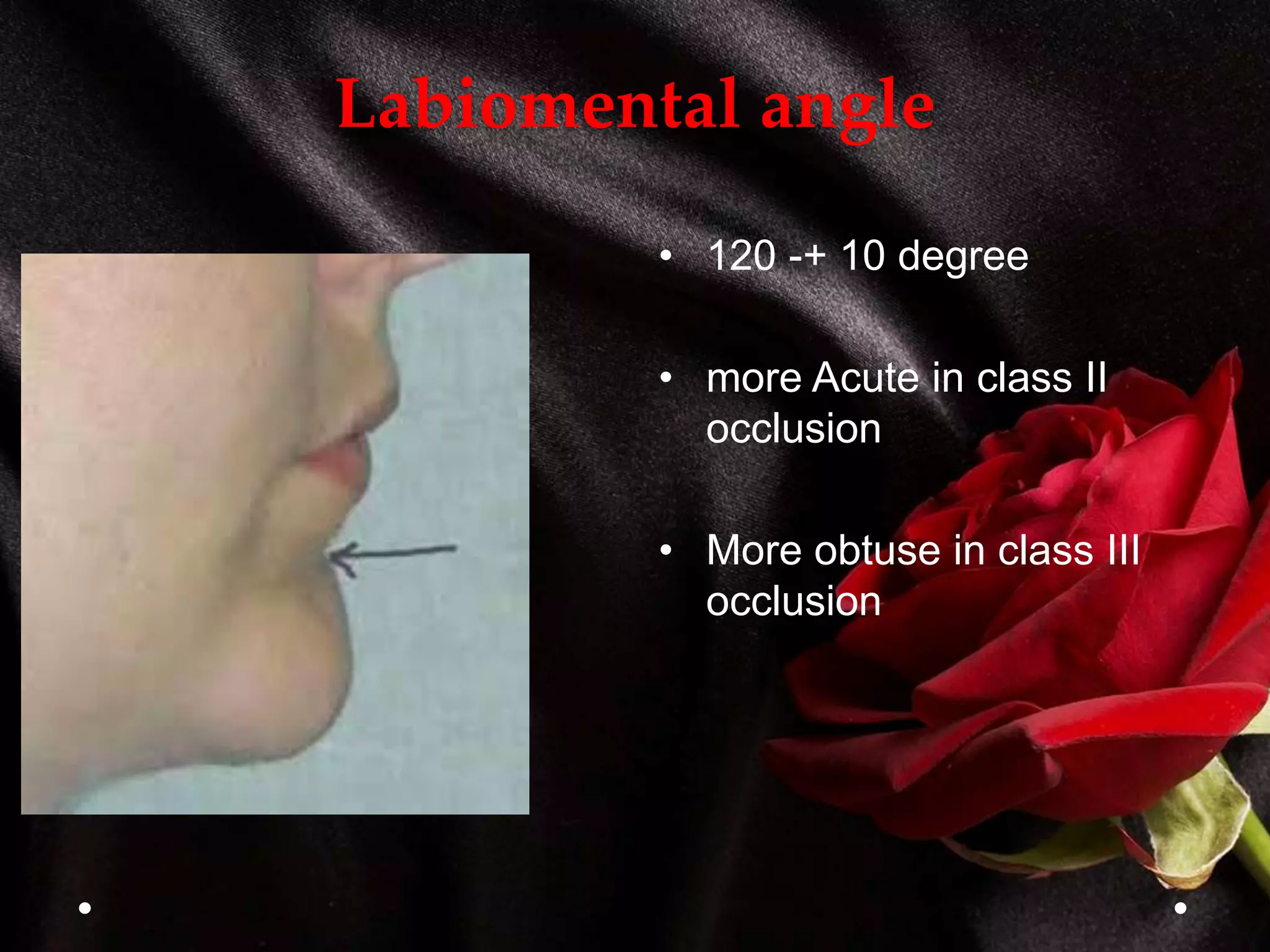 Orthognathic surgery | PPSX