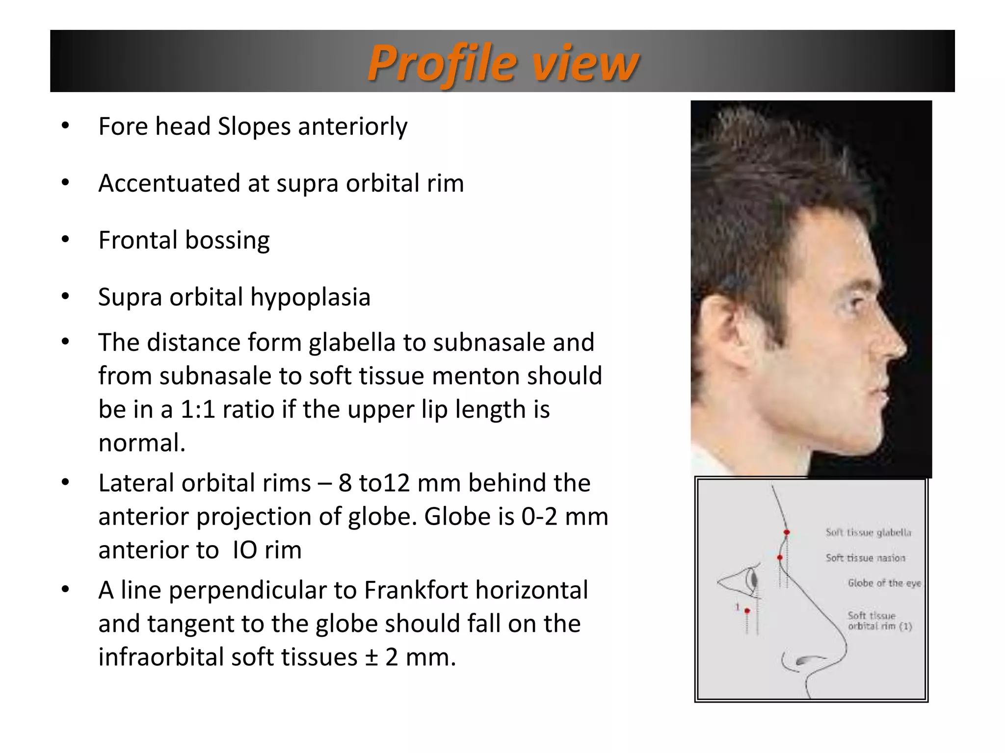Orthognathic surgery | PPTX