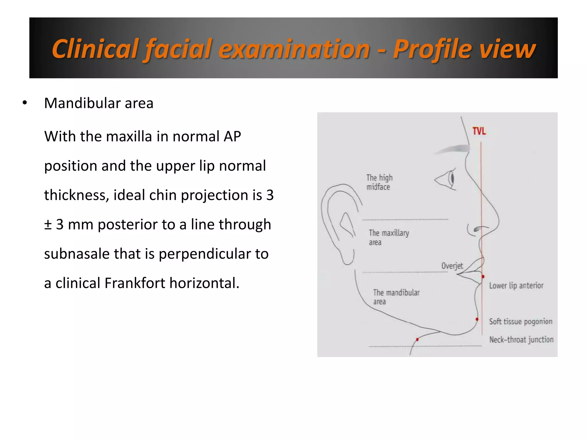 Orthognathic surgery | PPTX
