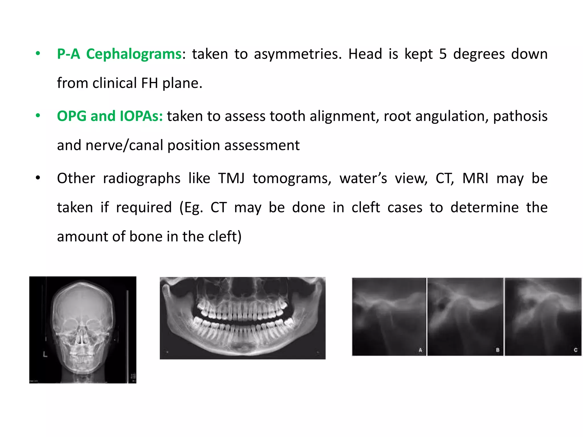 Orthognathic surgery | PPTX