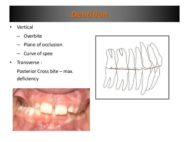 Orthognathic surgery