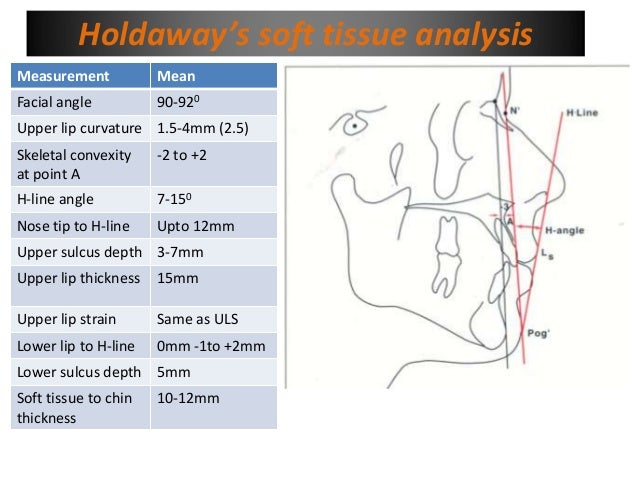 Orthognathic surgery