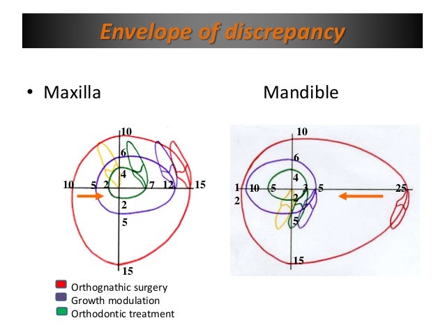 Orthognathic surgery