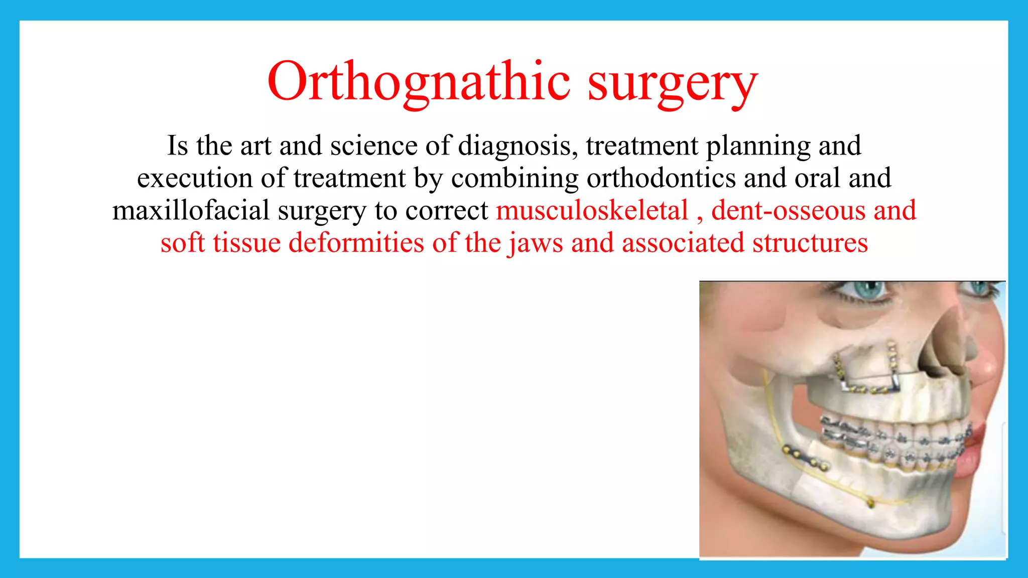 Orthognathic surgery / Dr.Sarah alkhateeb | PPTX