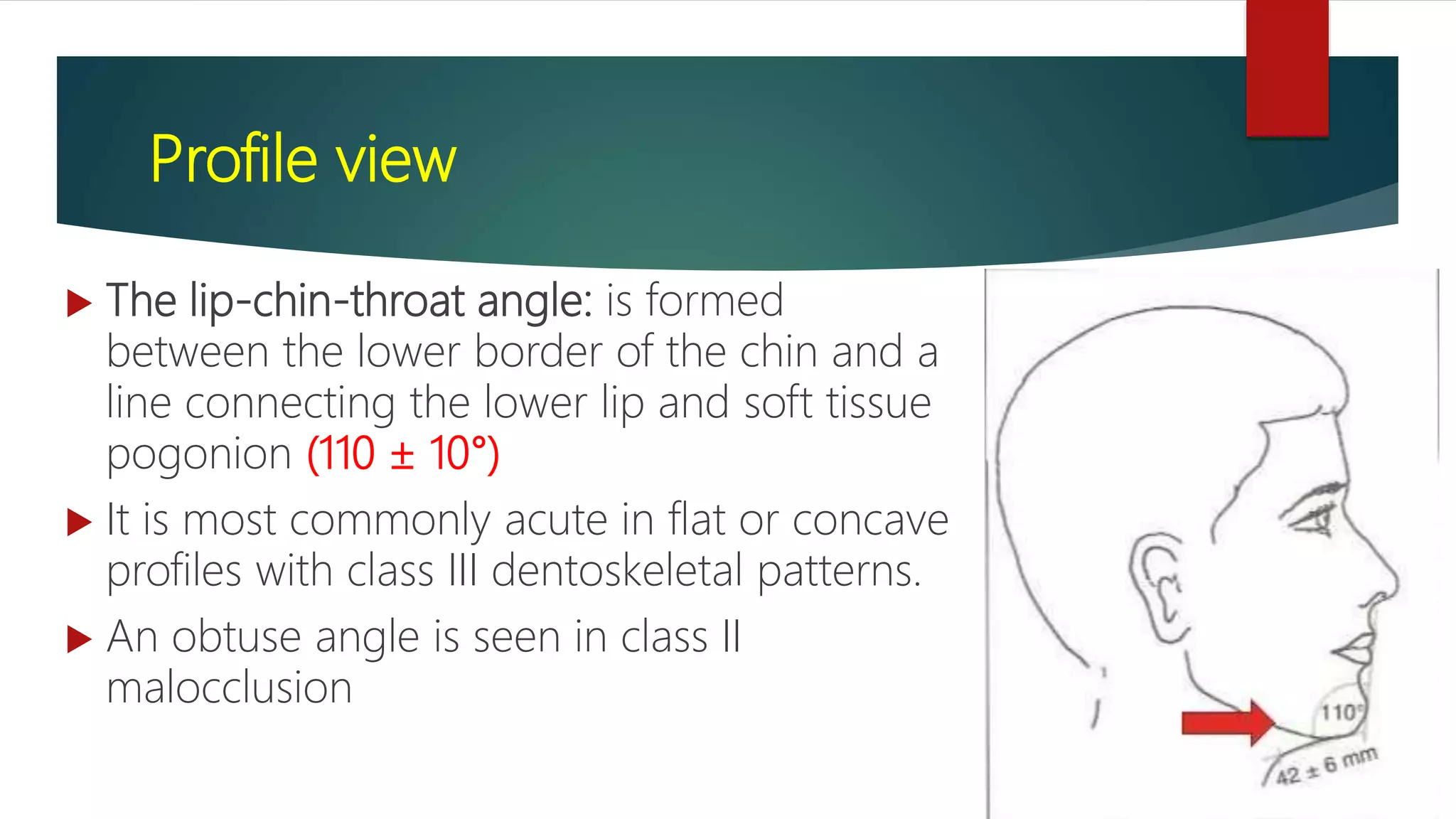 Orthognathic surgery | PPTX