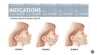 Orthognathic surgery ... | PPTX