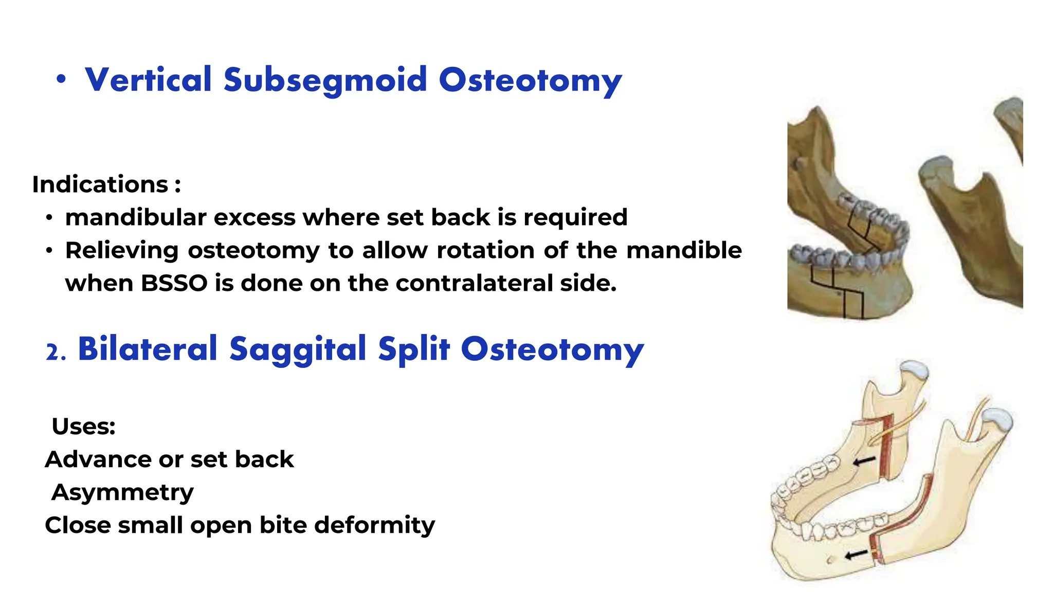 Orthognathic Surgery................pptx