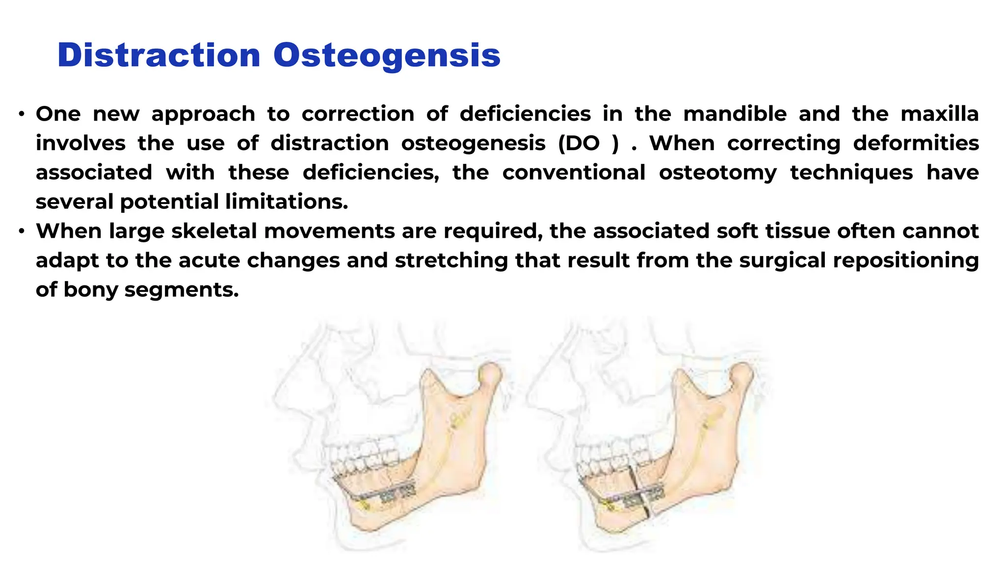 Orthognathic Surgery................pptx