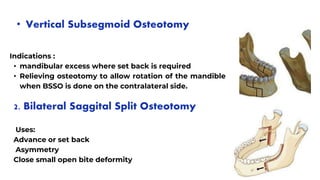 Orthognathic Surgery................pptx