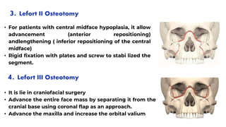 Orthognathic Surgery................pptx | Dental Health | Diseases and ...