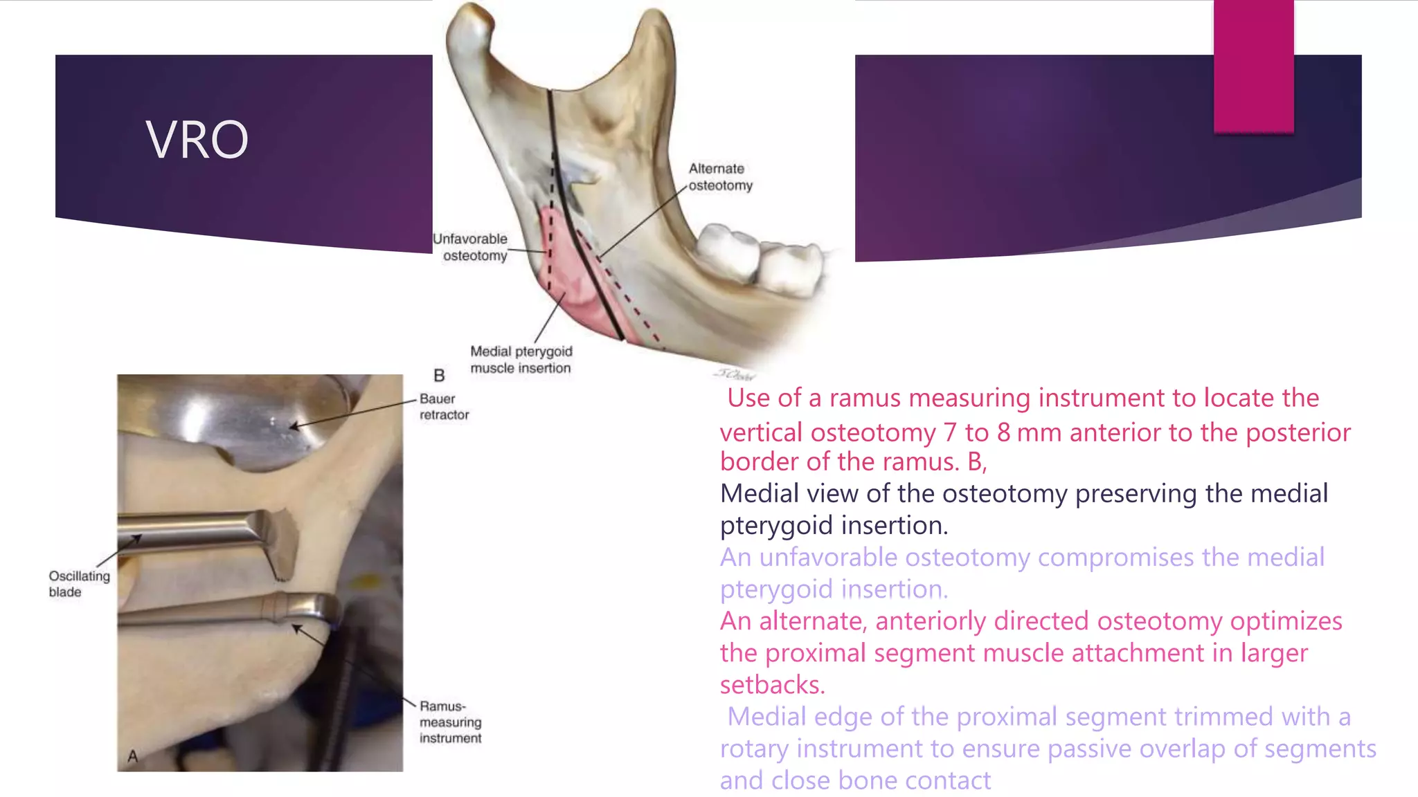 Orthognathic surgery basics session 1 | PPTX