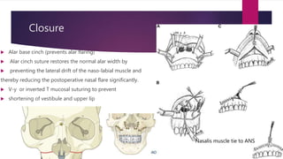 Orthognathic surgery basics session 1 | PPTX