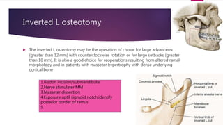 Orthognathic surgery basics session 1 | PPTX