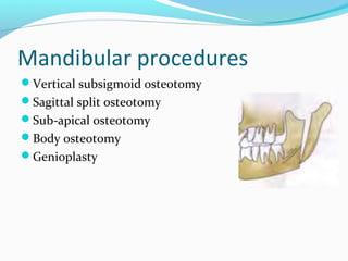 Orthognathic surgery new microsoft power point presentation | PPT