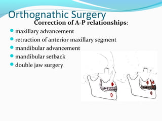 Orthognathic surgery new microsoft power point presentation | PPT