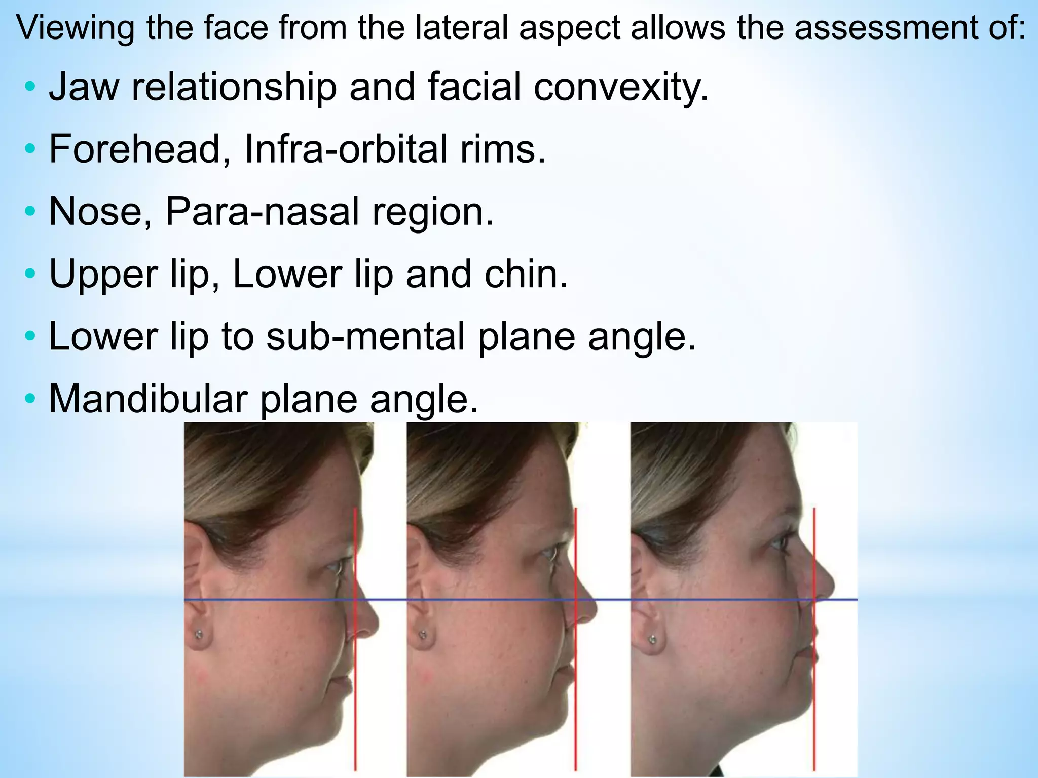 Orthognathic treatment for skeletal class iii malocclusion nehal fouad ...